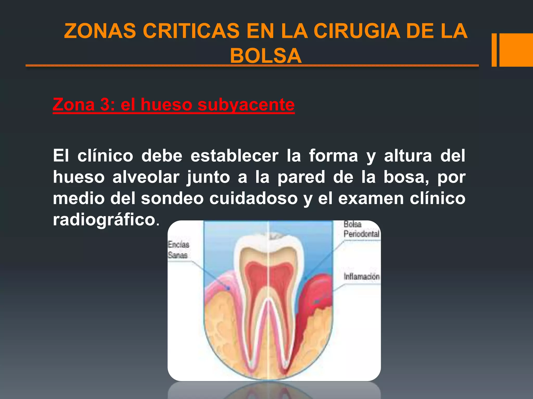 Fases del tratamiento periodontal, Carranza, Periodontología clínica, Décima edicion | PPTX