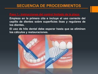 Fases del tratamiento periodontal, Carranza, Periodontología clínica, Décima edicion | PPTX