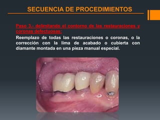 Fases del tratamiento periodontal, Carranza, Periodontología clínica, Décima edicion | PPTX