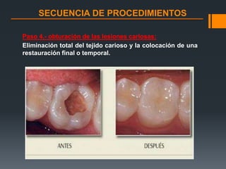Fases del tratamiento periodontal, Carranza, Periodontología clínica, Décima edicion | PPTX