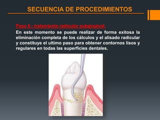 Fases del tratamiento periodontal, Carranza, Periodontología clínica ...