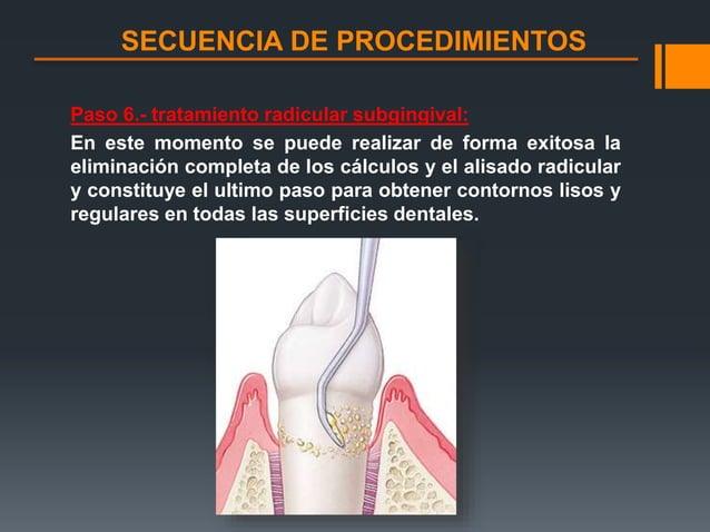 Fases del tratamiento periodontal, Carranza, Periodontología clínica ...