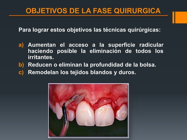 Fases del tratamiento periodontal, Carranza, Periodontología clínica ...