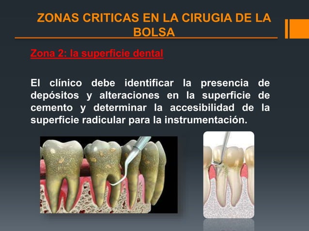Fases del tratamiento periodontal, Carranza, Periodontología clínica, Décima edicion | PPTX