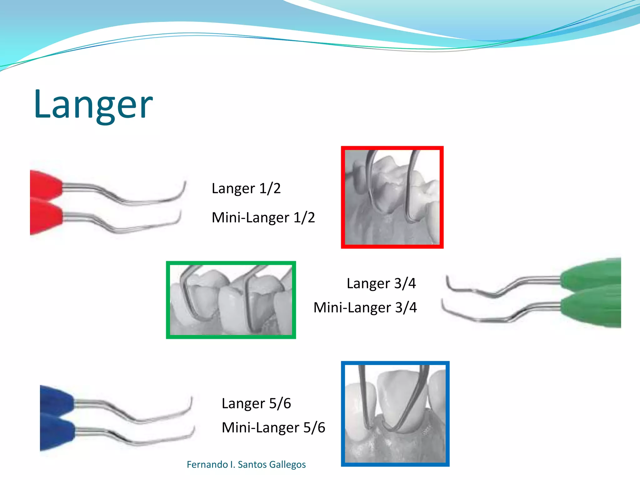 Fases de tratamiento periodontal