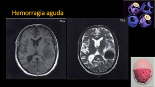 FASES HEMORRAGIA RM.pptx