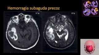 FASES HEMORRAGIA RM.pptx