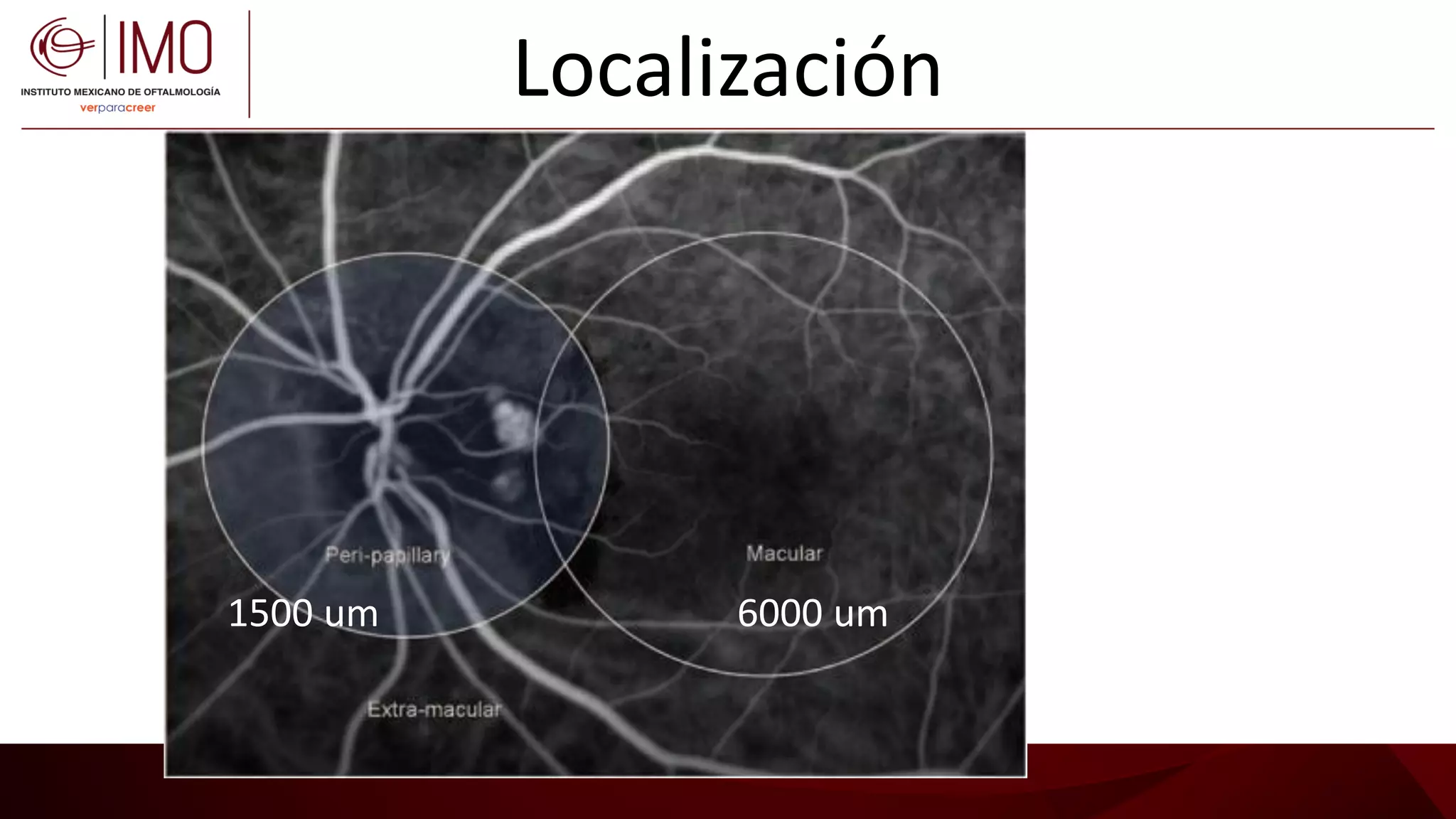 Angiografia con Verde de indocianina: Fases y patrones en VCP ...