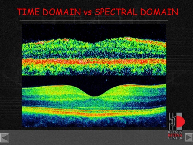 Fasolino oct fag icg