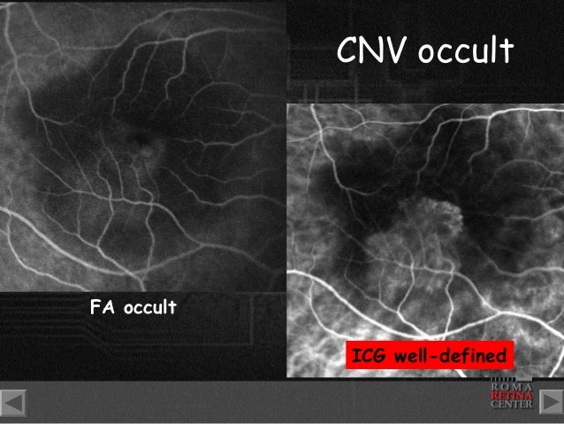 Fasolino oct fag icg