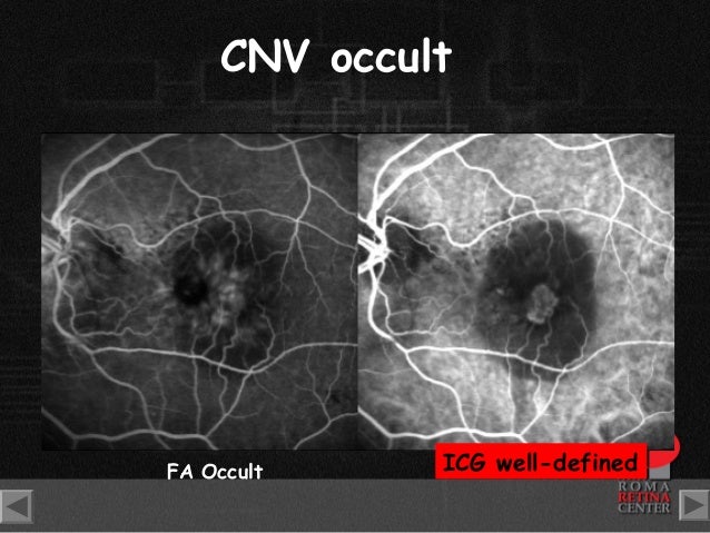 Fasolino oct fag icg