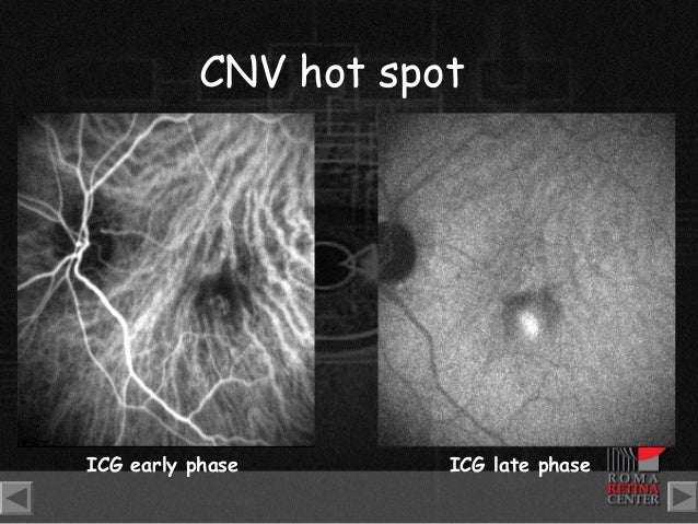 Fasolino oct fag icg
