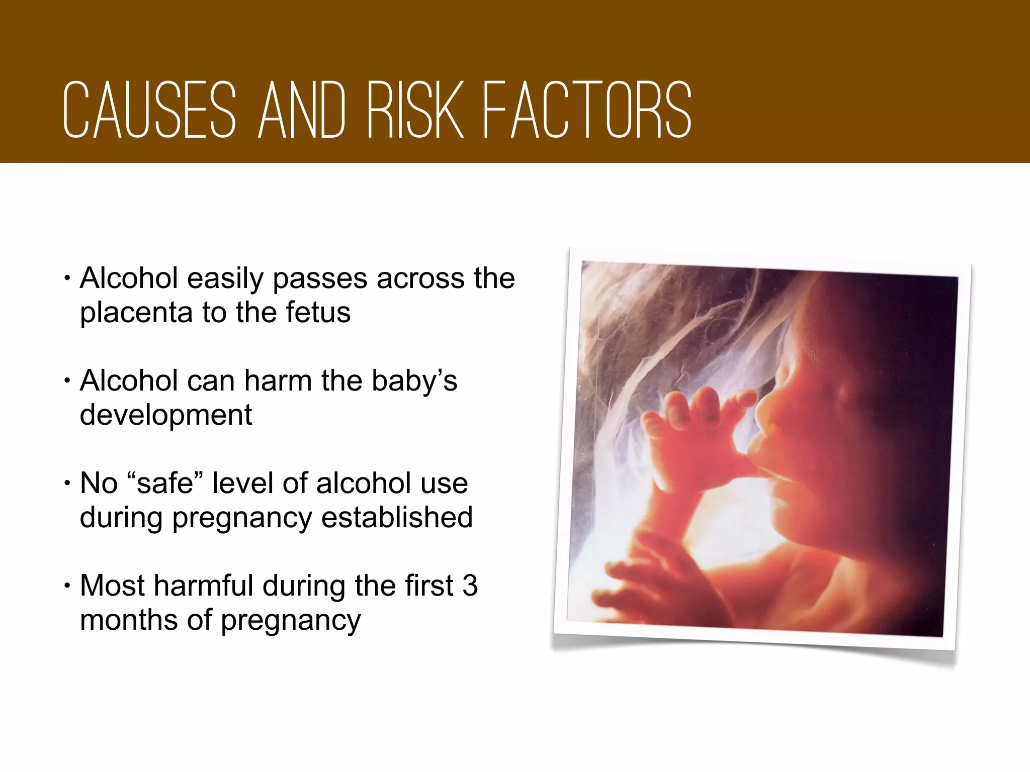 Conditions Presentation: FAS and Prenatal Drug Exposure | PDF