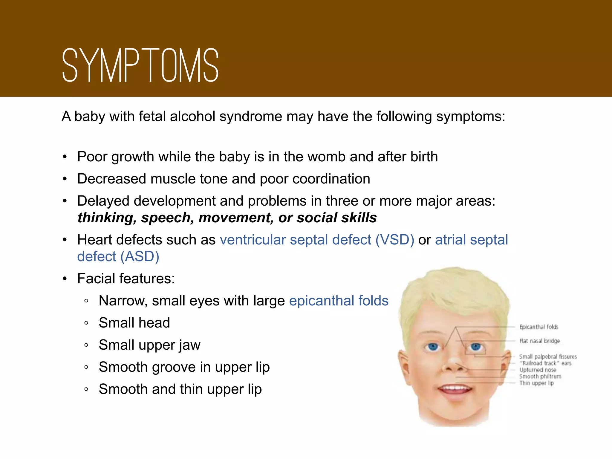 Conditions Presentation: FAS and Prenatal Drug Exposure | PDF