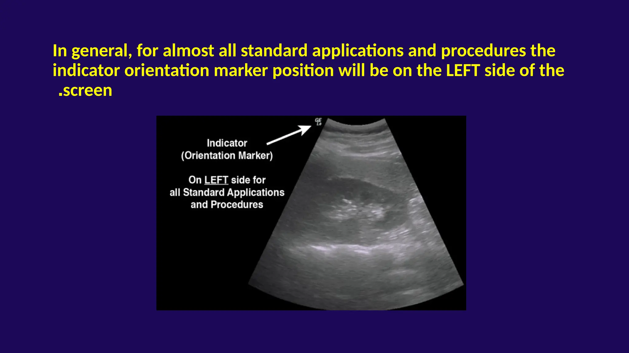ULTRASOUND ITRADUCTION, machine , probes | PPT