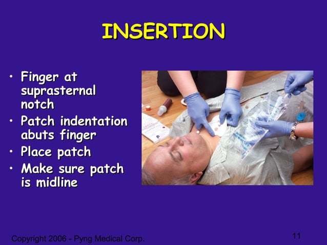 Fast1 training ppt 2006 - mil - compress | PPT