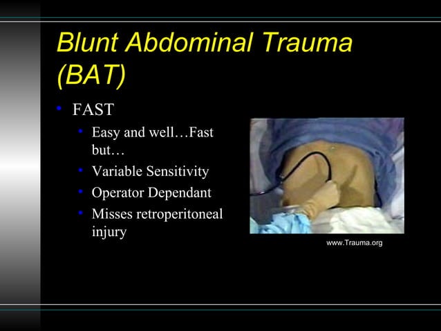 Sonographic Assessment of Blunt Abdominal Trauma in the Emergency ...