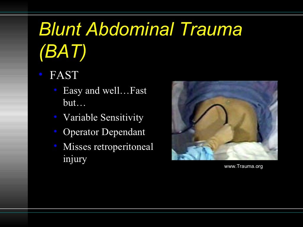 Sonographic Assessment of Blunt Abdominal Trauma in the Emergency Dep…
