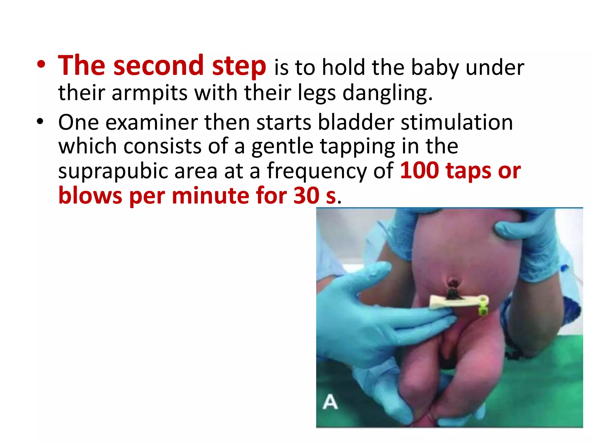 Fast and safe technique for collection of urine in newborns | PPTX