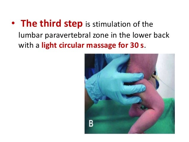 Fast and safe technique for collection of urine in newborns