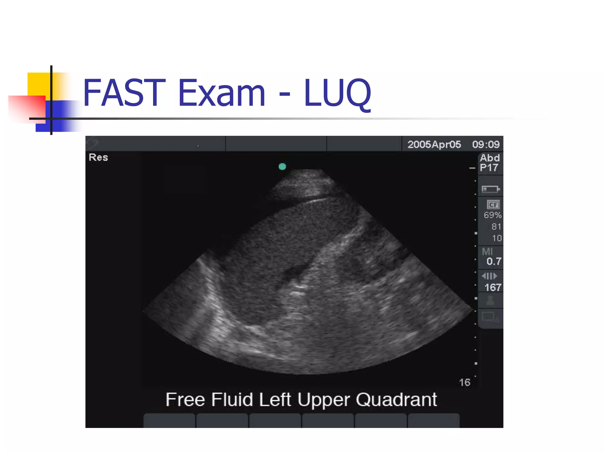 Fast by nurses ppt. | PPTX | First Aid | Injuries