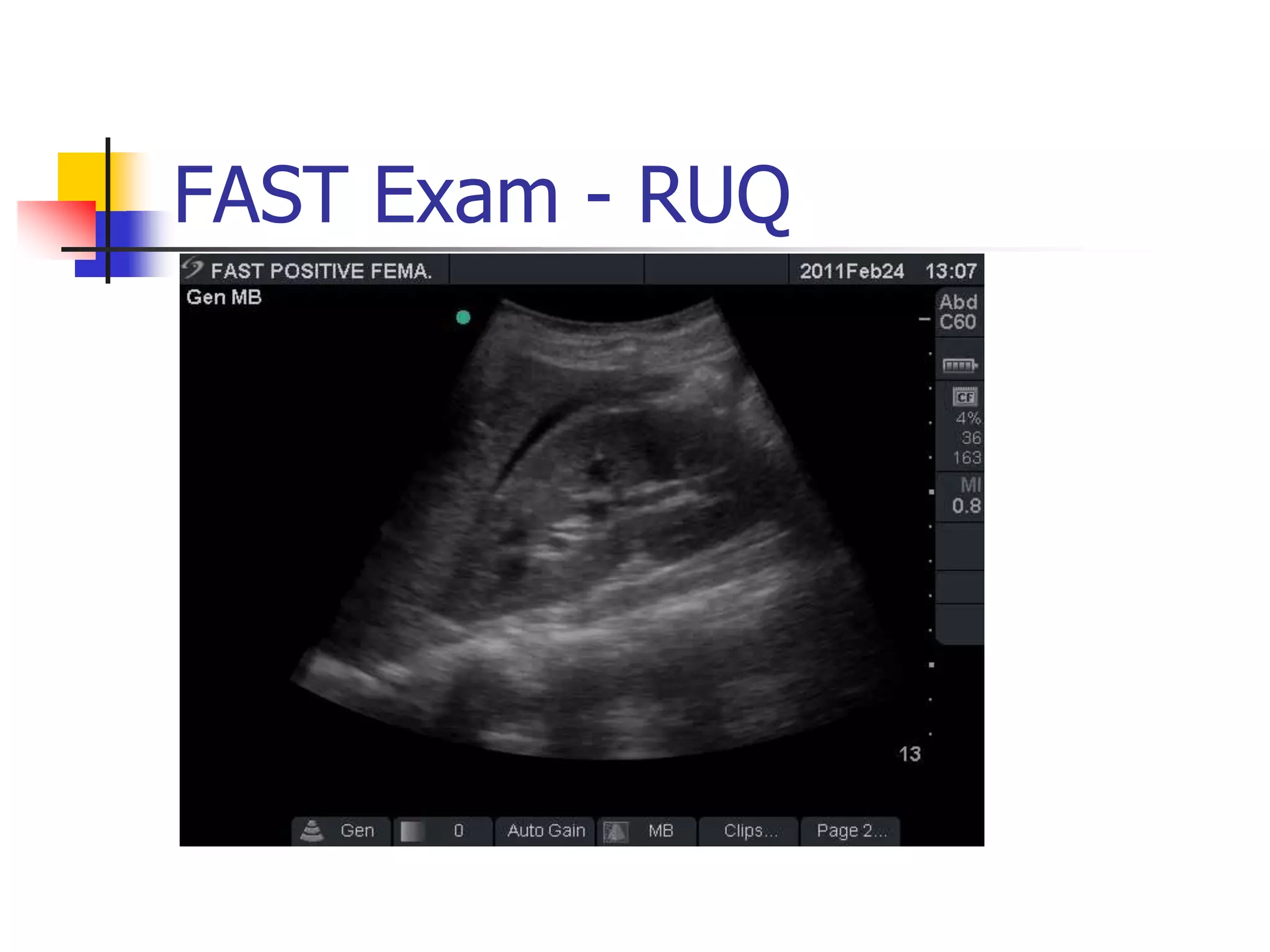 Fast by nurses ppt. | PPTX | First Aid | Injuries