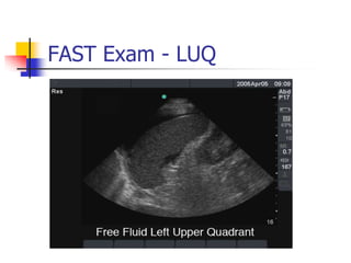 Fast by nurses ppt. | PPTX | First Aid | Injuries