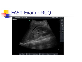 Fast by nurses ppt. | PPTX | First Aid | Injuries