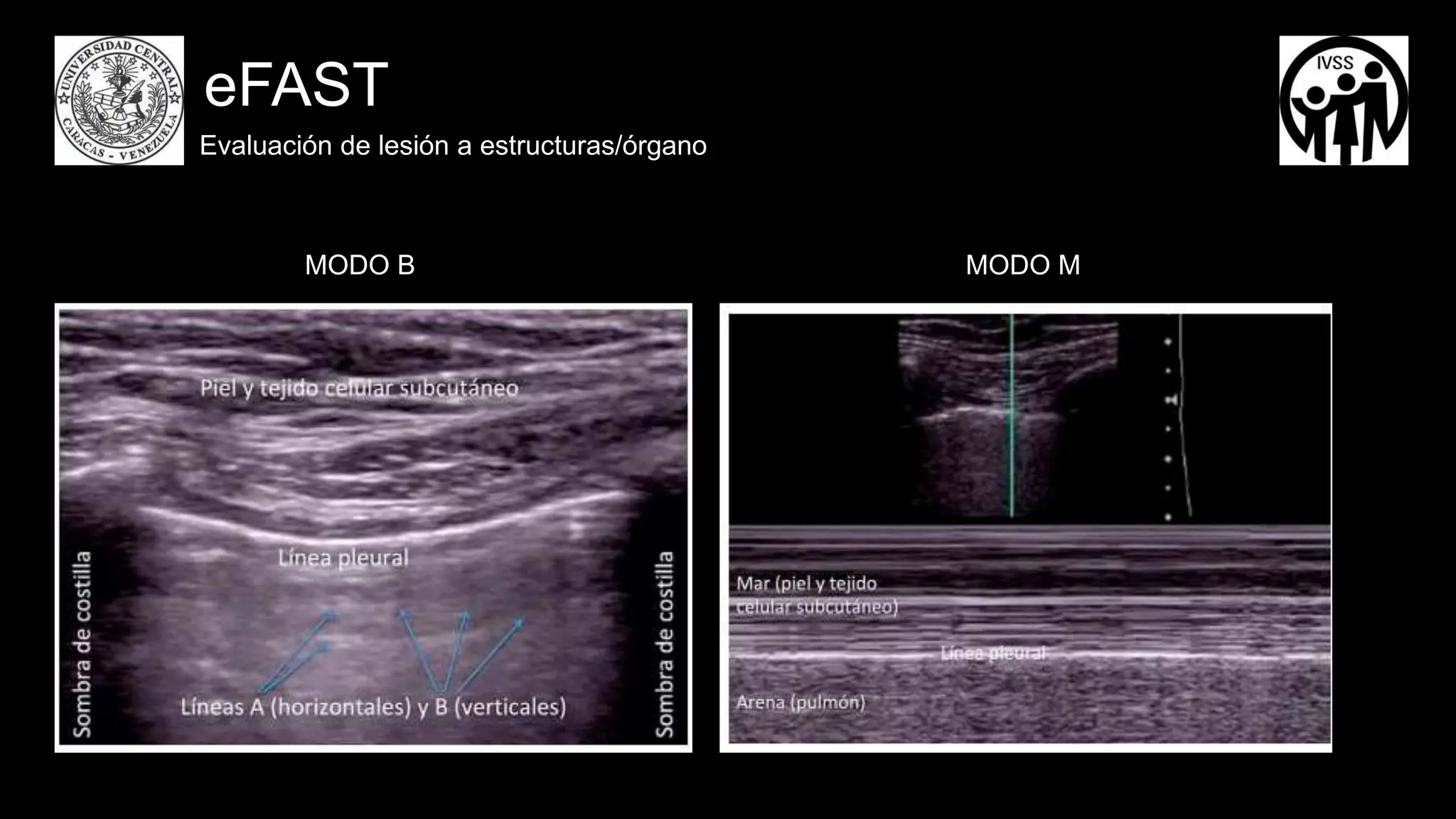 FAST EFAST TRAUMA DE ORGANOS CERRADOS.pptx