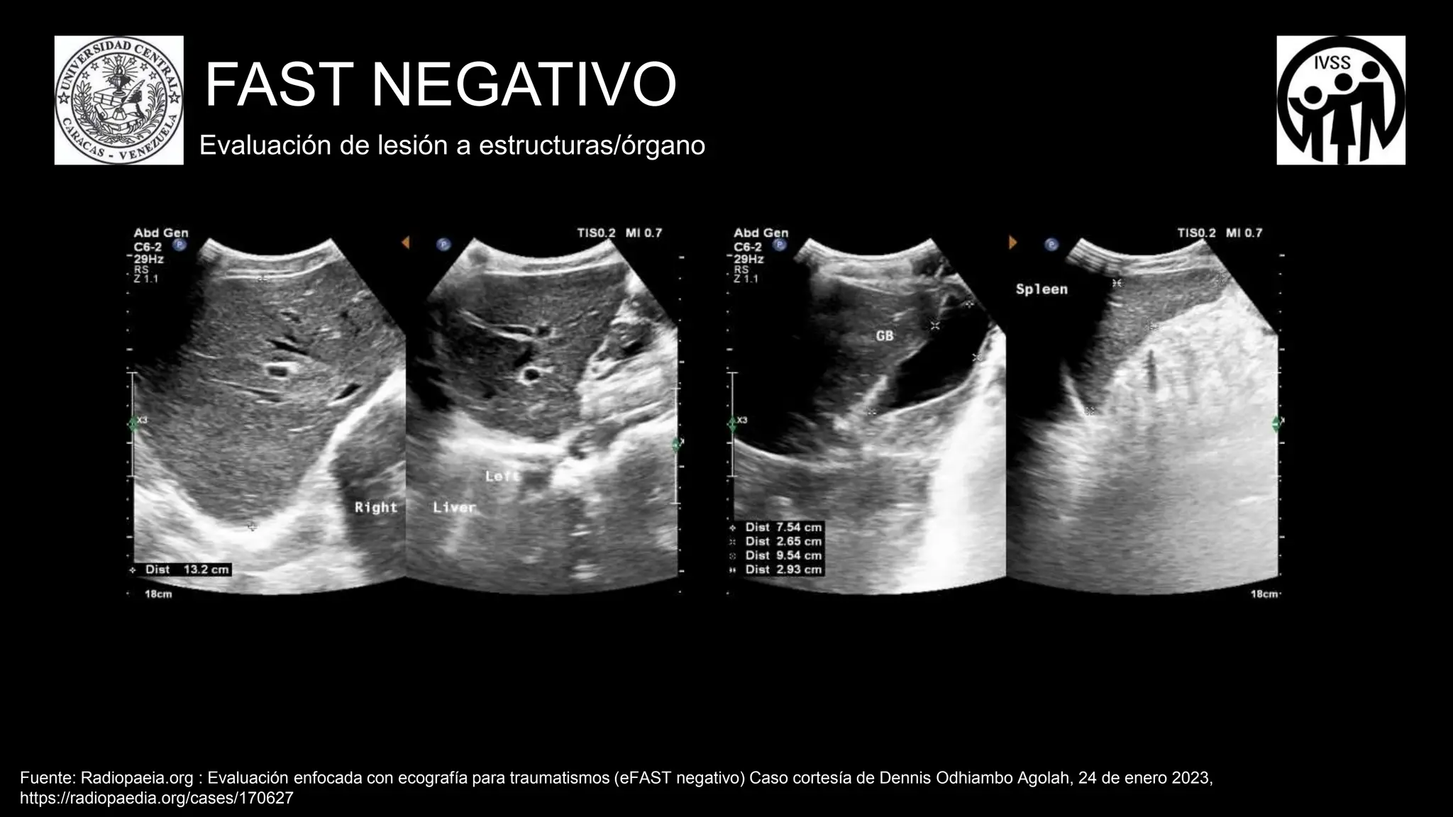 FAST EFAST TRAUMA DE ORGANOS CERRADOS.pptx