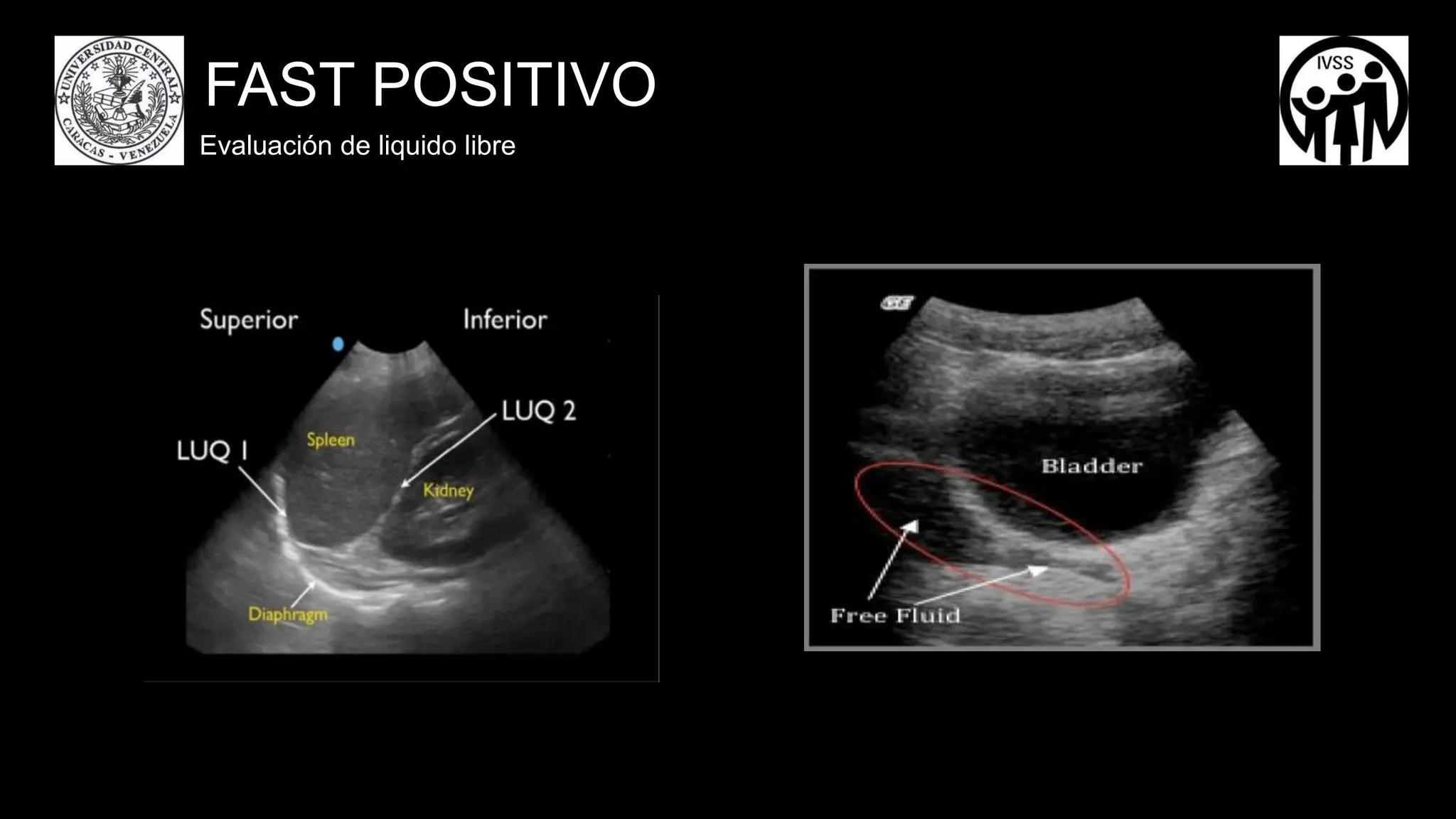FAST EFAST TRAUMA DE ORGANOS CERRADOS.pptx