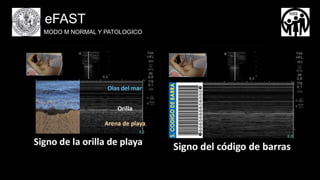 FAST EFAST TRAUMA DE ORGANOS CERRADOS.pptx