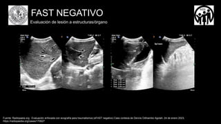 FAST EFAST TRAUMA DE ORGANOS CERRADOS.pptx