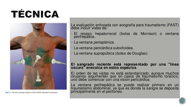 Fast (Focused assessment with sonography for trauma)