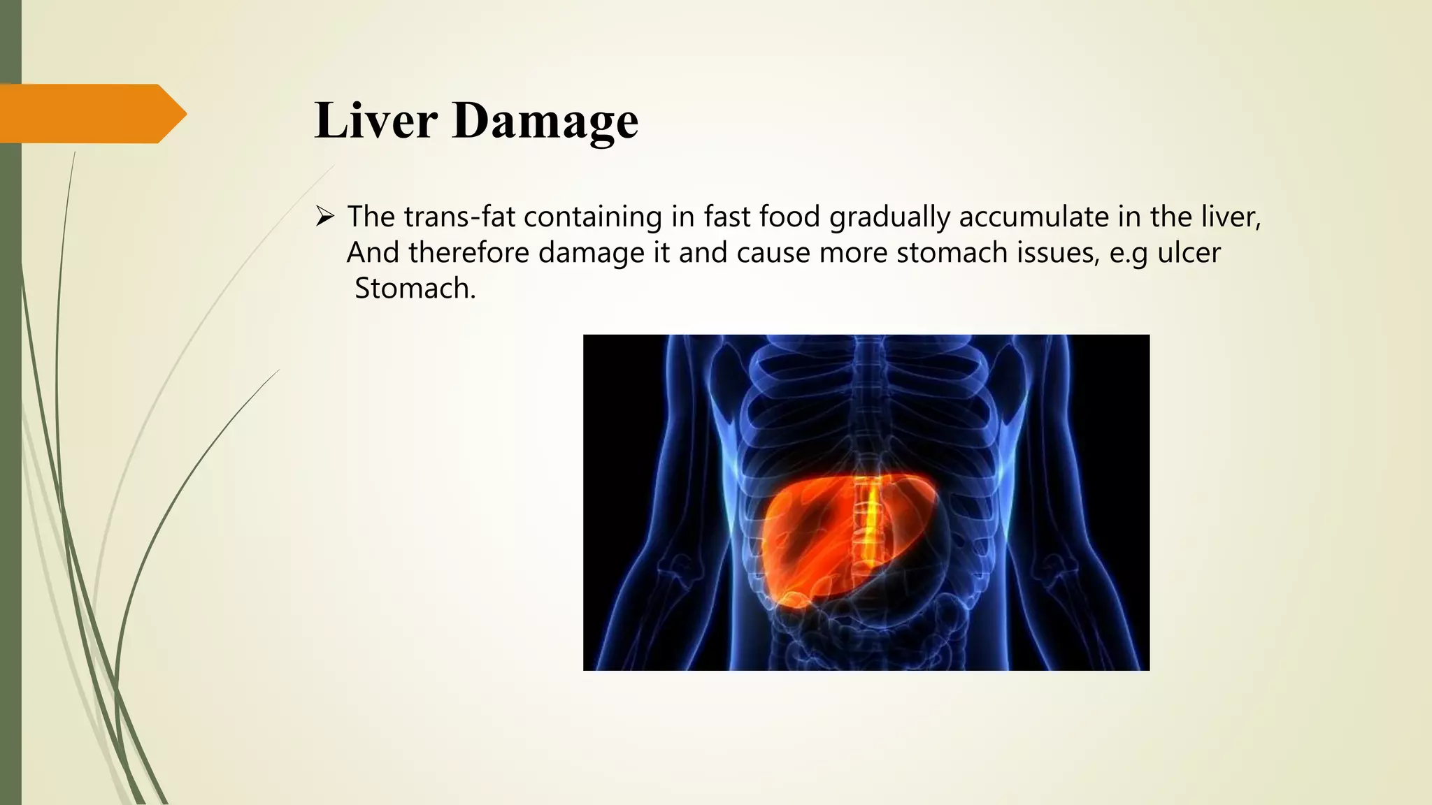 Fast food is injurious to health-1 (2).pptx