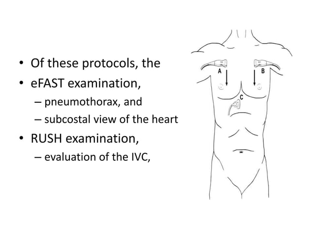 Focused Assessment with Sonography in Trauma (FAST) in 2017 | PPTX