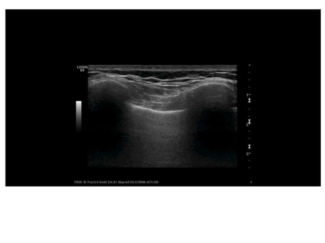 Focused Assessment with Sonography in Trauma (FAST) in 2017 | PPTX