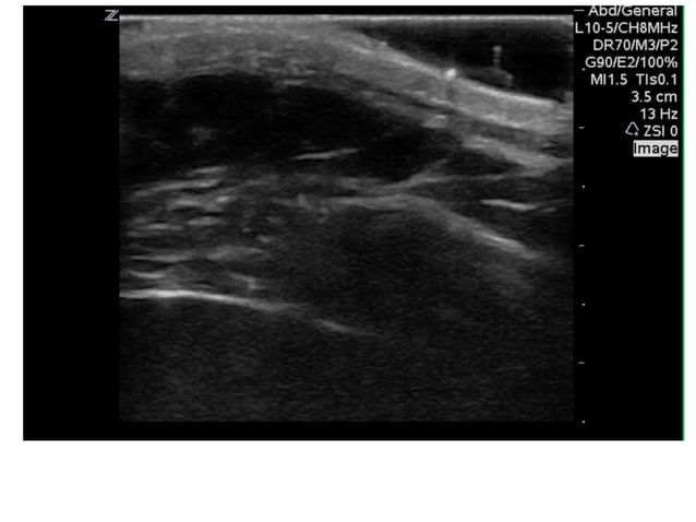 Focused Assessment with Sonography in Trauma (FAST) in 2017 | PPTX