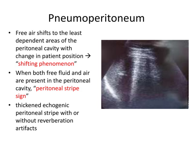 Focused Assessment with Sonography in Trauma (FAST) in 2017 | PPTX