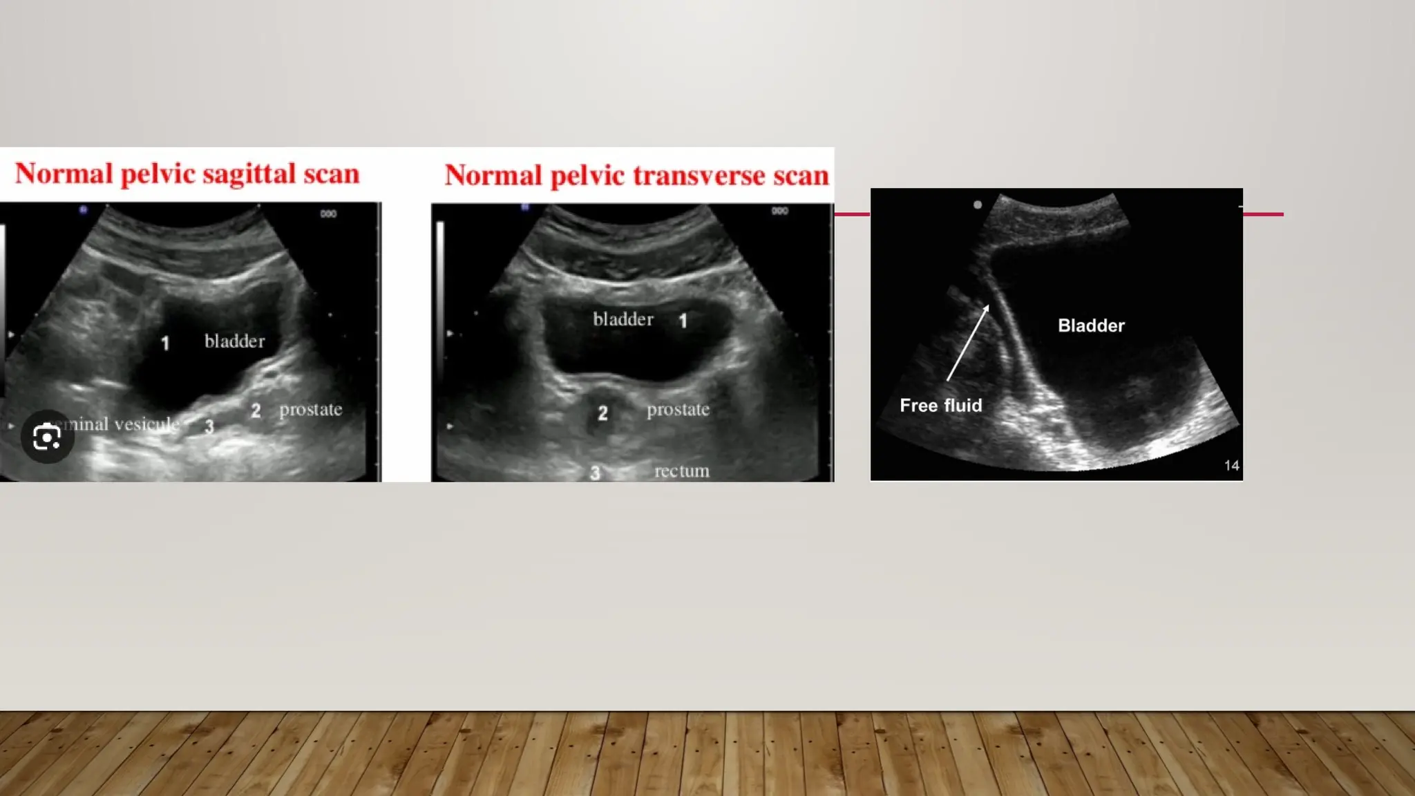 Fast scan presentation.pptx what is fast scan? | PPT