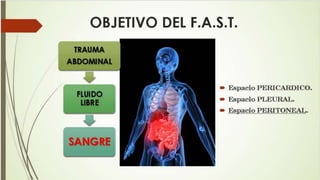 FAST EN TRAUMA ABDOMINAL | PPTX | Medical Tests | Medical Health