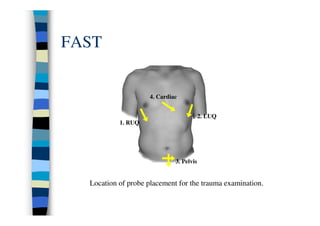 Focused Abdominal Sonography for Trauma | PDF