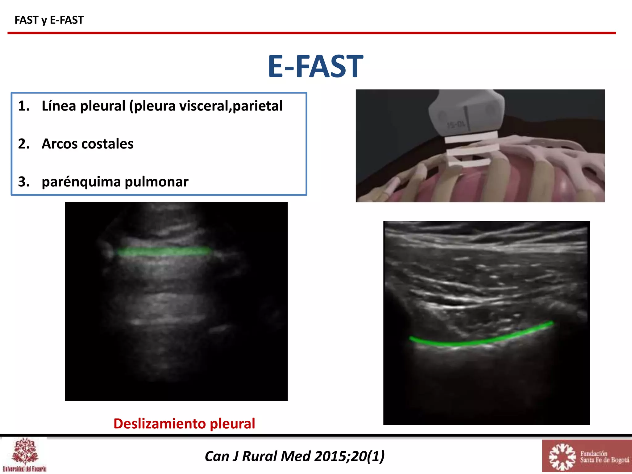 Fast y e fast | PPTX | Surgery | Medical Health