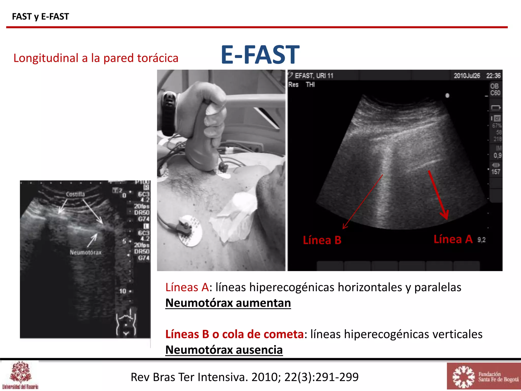 Fast y e fast | PPTX | Surgery | Medical Health