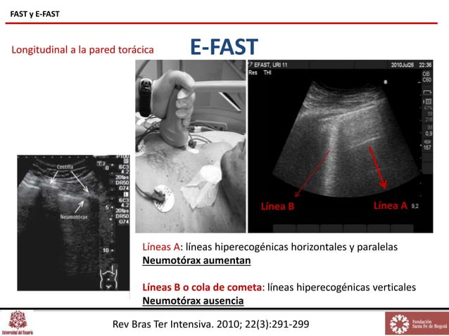 Fast y e fast | PPTX | Surgery | Medical Health