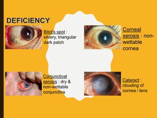 Fat soluble vitamins | PPT
