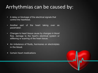Fatal-Arrhythmias by henry ligutum (Northern Mindanao Medical Center) | PPT