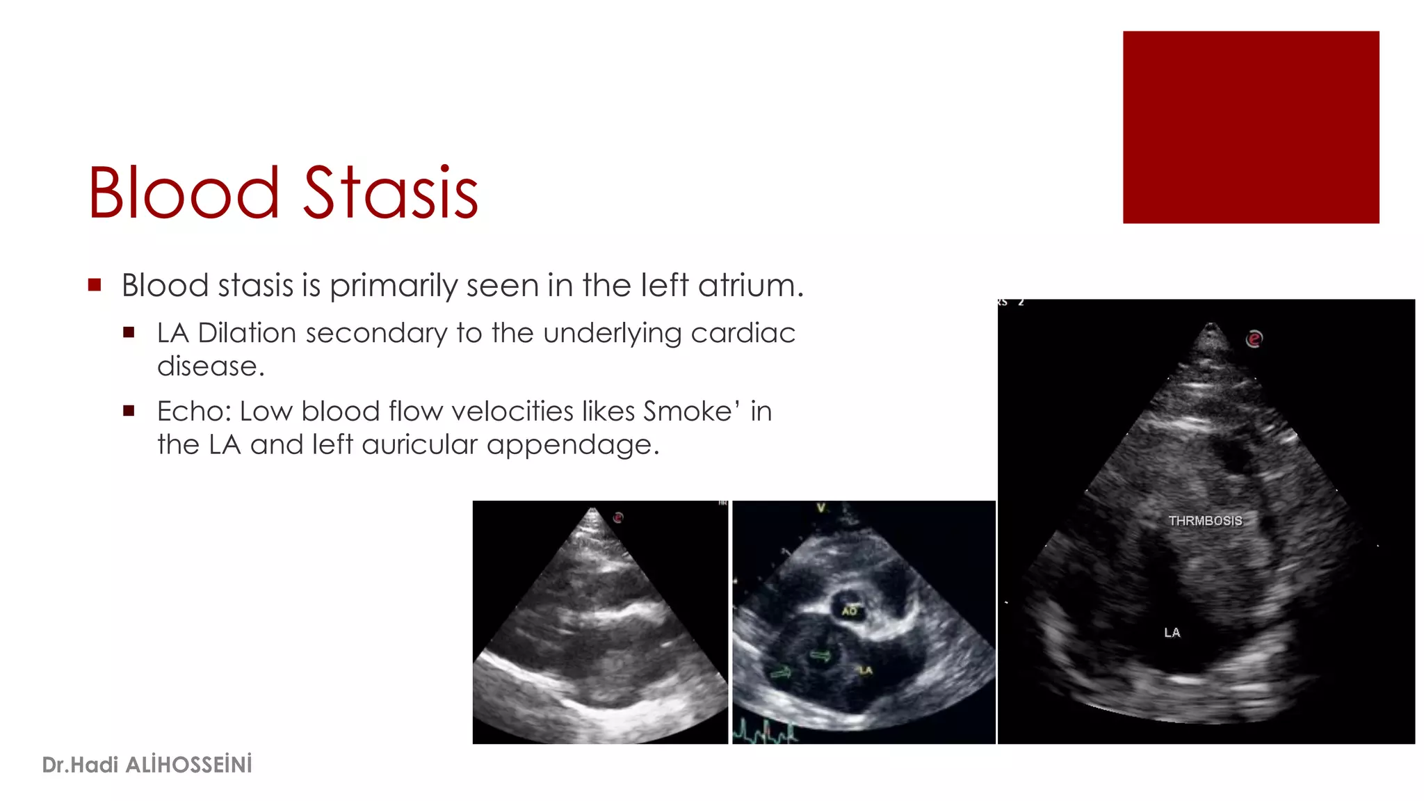 Feline Arterial Thromboembolism | PDF