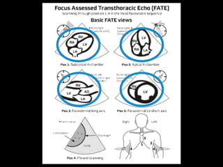 FATE-Basic Cardiac Ultrasound I | PPTX