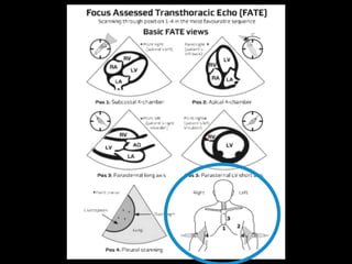 FATE-Basic Cardiac Ultrasound I | PPTX